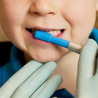 Z-Vibes | All Tips, Kits, & Accessories | ARK Therapeutic